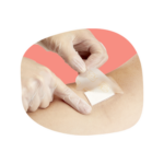 Epigard, Hautersatz zur temporären Wundabdeckung. | Walter CMP